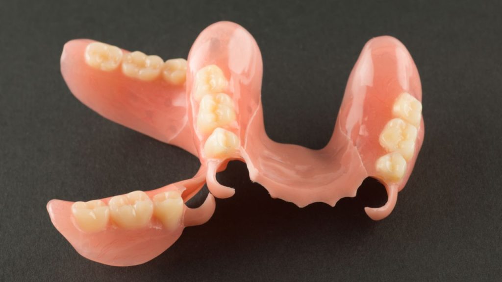 Prótese dentária flexível: saiba tudo sobre e preço!