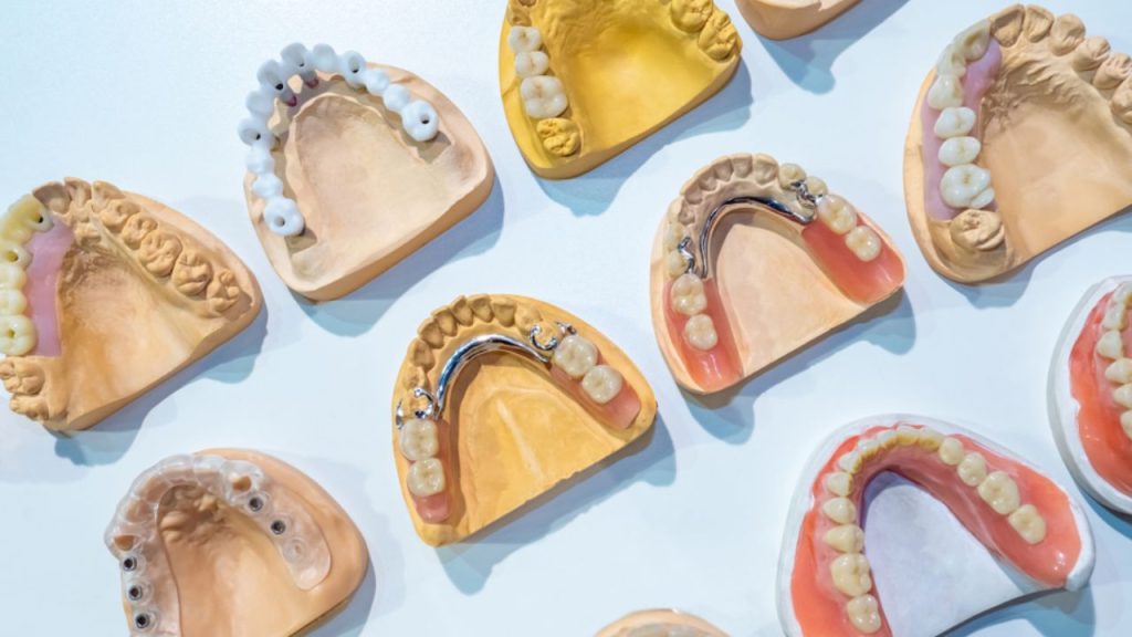 Tipos de prótese dentária: conheça aqui todos os modelos!