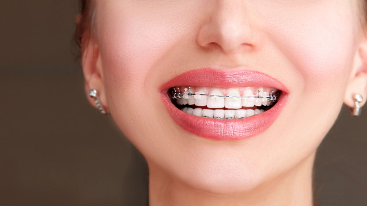 Conheça quais são os 3 tipos de aparelho estético existentes