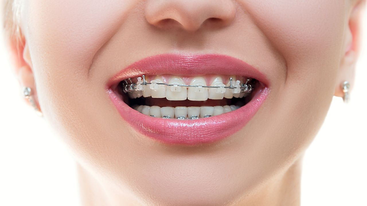 Descubra quais os 3 tipos de aparelho estético existentes!