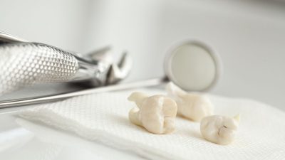 Confira como é feito o procedimento de extrair dente siso