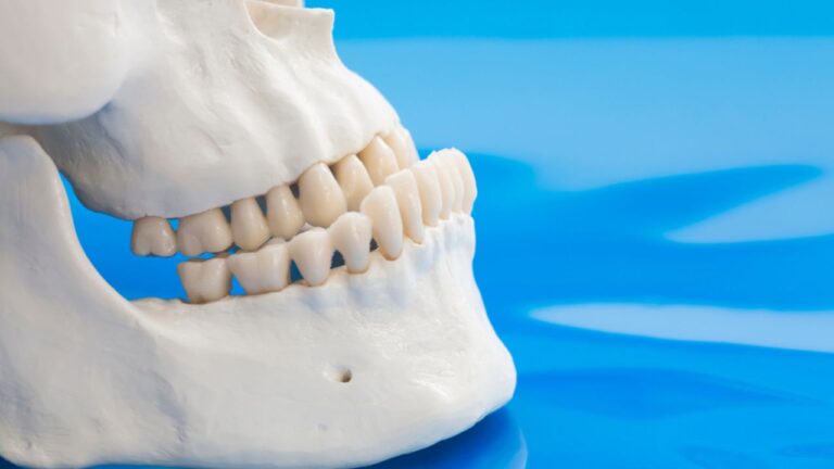 Saiba o que causa e como corrigir o queixo para frente