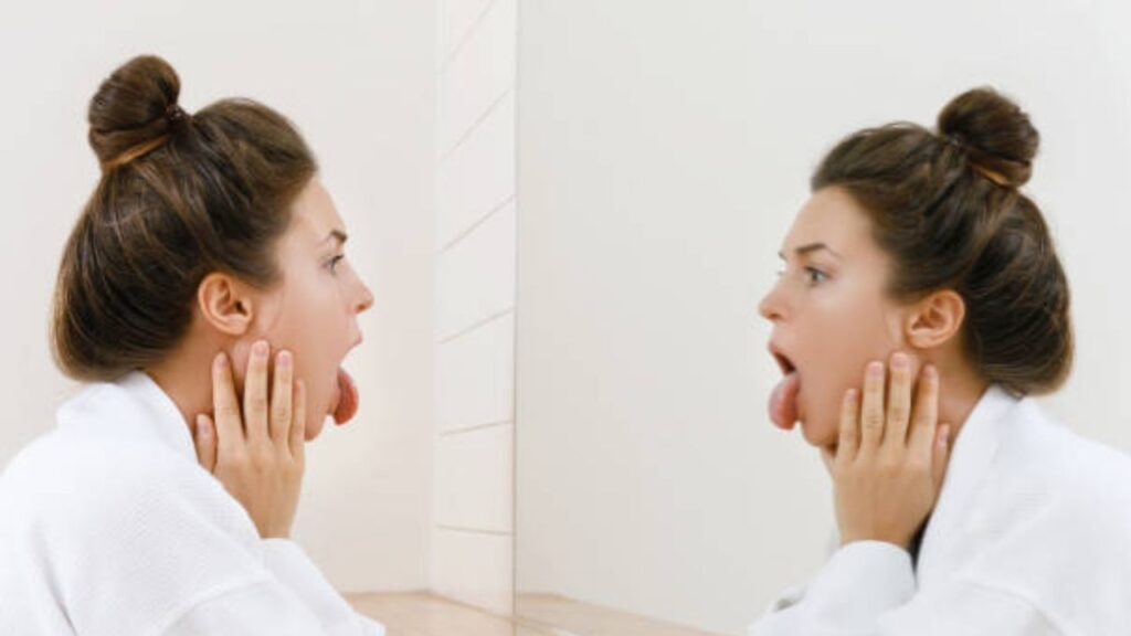 Sapinho na lingua: o que é, causas, prevenção e como tratar!