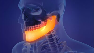 Disfunção temporomandibular e dor orofacial: saiba mais!