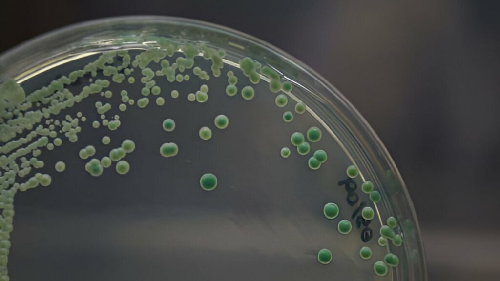 Candidíase oral: confira o guia definitivo sobre o assunto!