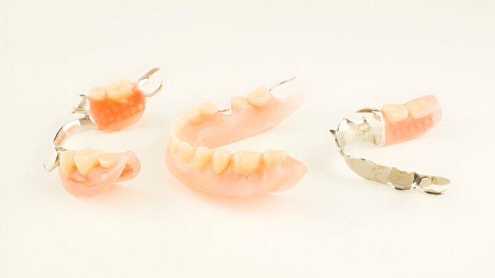 Prótese Parcial Removível: passo a passo e 7 benefícios!