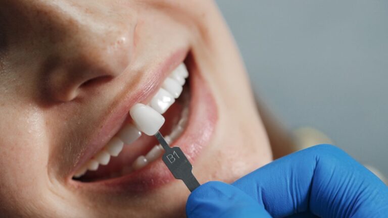 Prótese adesiva: o que é e como funciona - Blog OralDents