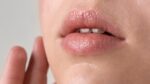 Lábios ressecados: quais são as causas e tratamentos