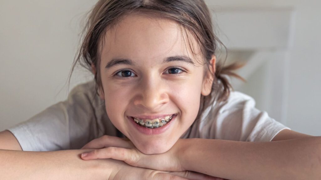 Tipos de aparelho de dente: veja quais são os principais!