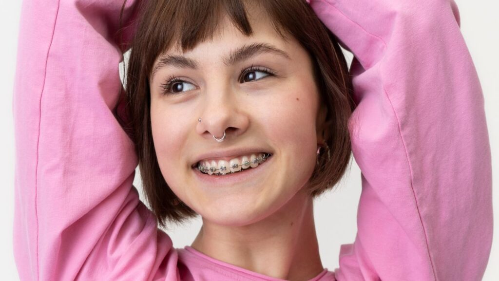 Aparelho móvel infantil: como funciona? - OralDents