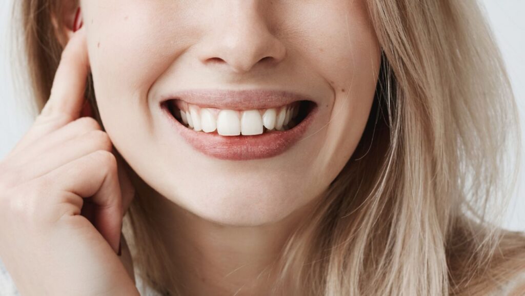 Dente torto: Entenda tudo sobre! - OralDents
