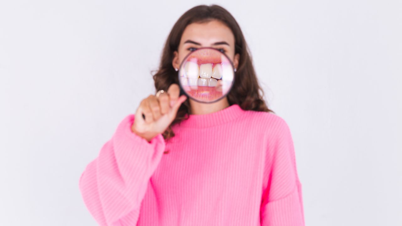 Fluorose dentária: causas, sintomas, tratamentos e prevenção