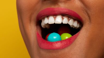 Agenesia dentaria: o que é e como tratar - OralDents