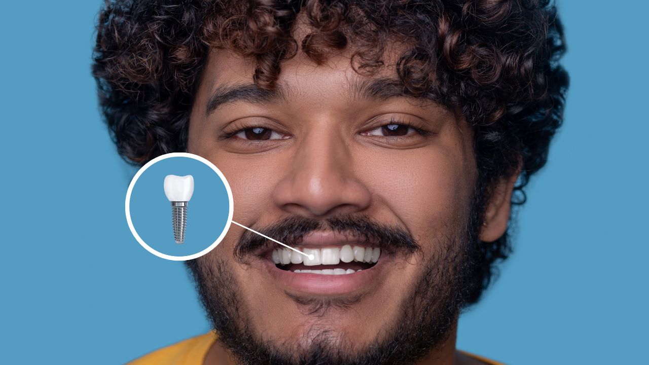 Com quantos anos pode colocar aparelho ortodôntico?