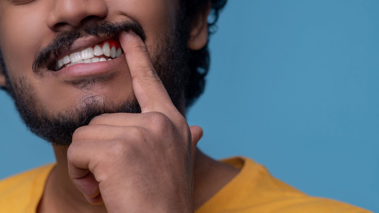 Dente mole: entenda como tratar! - OralDents